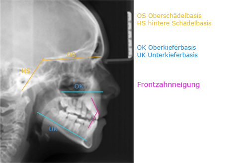 DENTALPRAX - Dres. Sommerfeld, Weil der Stadt: Röntgen